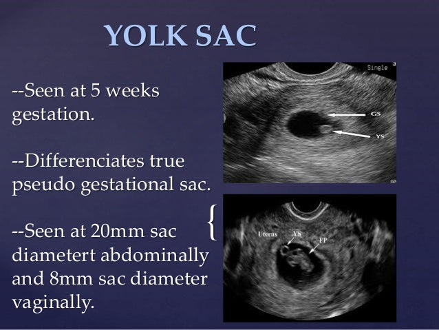 Basic Obstetric Ultrasound Training