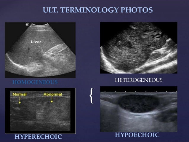 BASIC OBSTETRIC ULTRASOUND TRAINING
