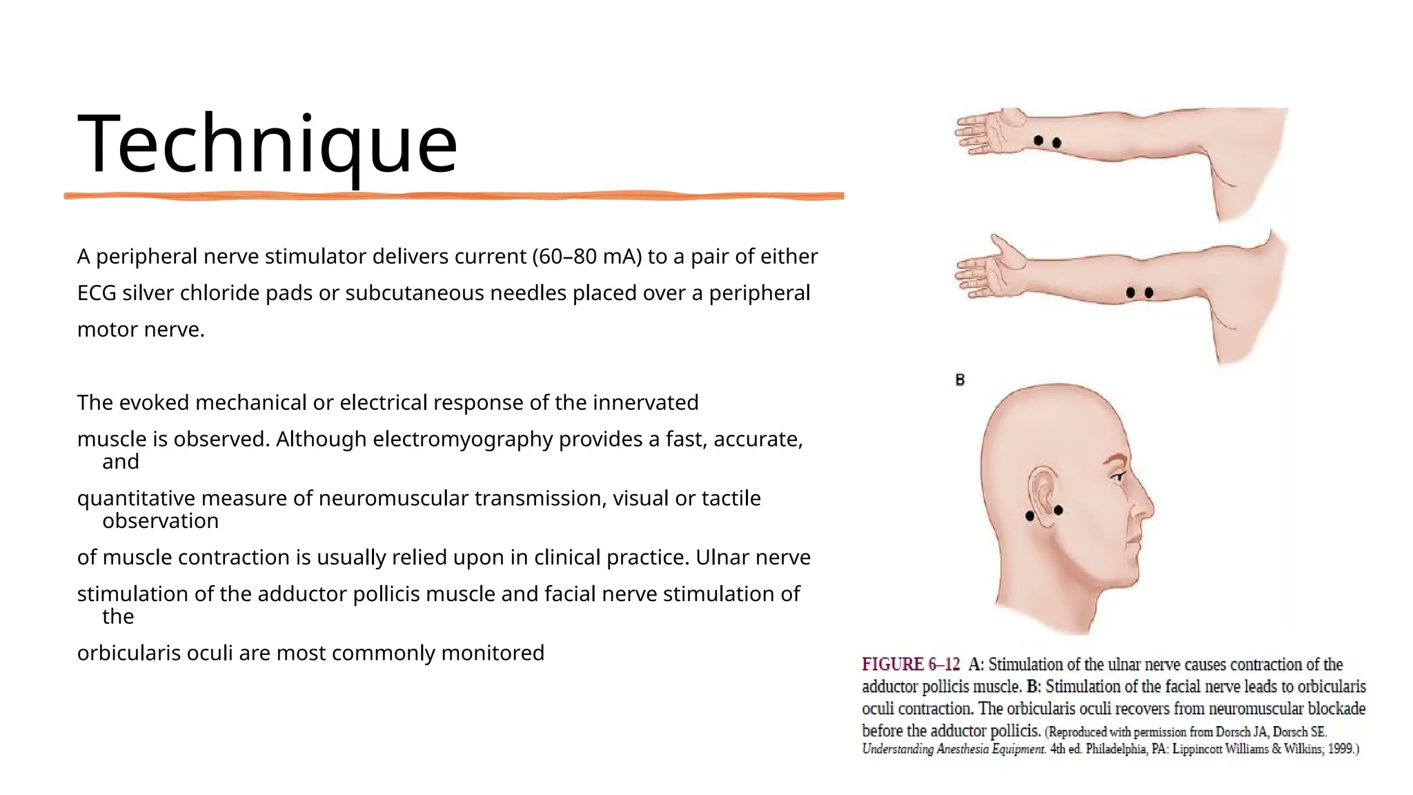 Train of four method using peripheral nerve stimulator | PPTX