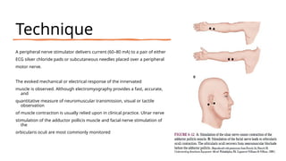 Train of four method using peripheral nerve stimulator | PPTX