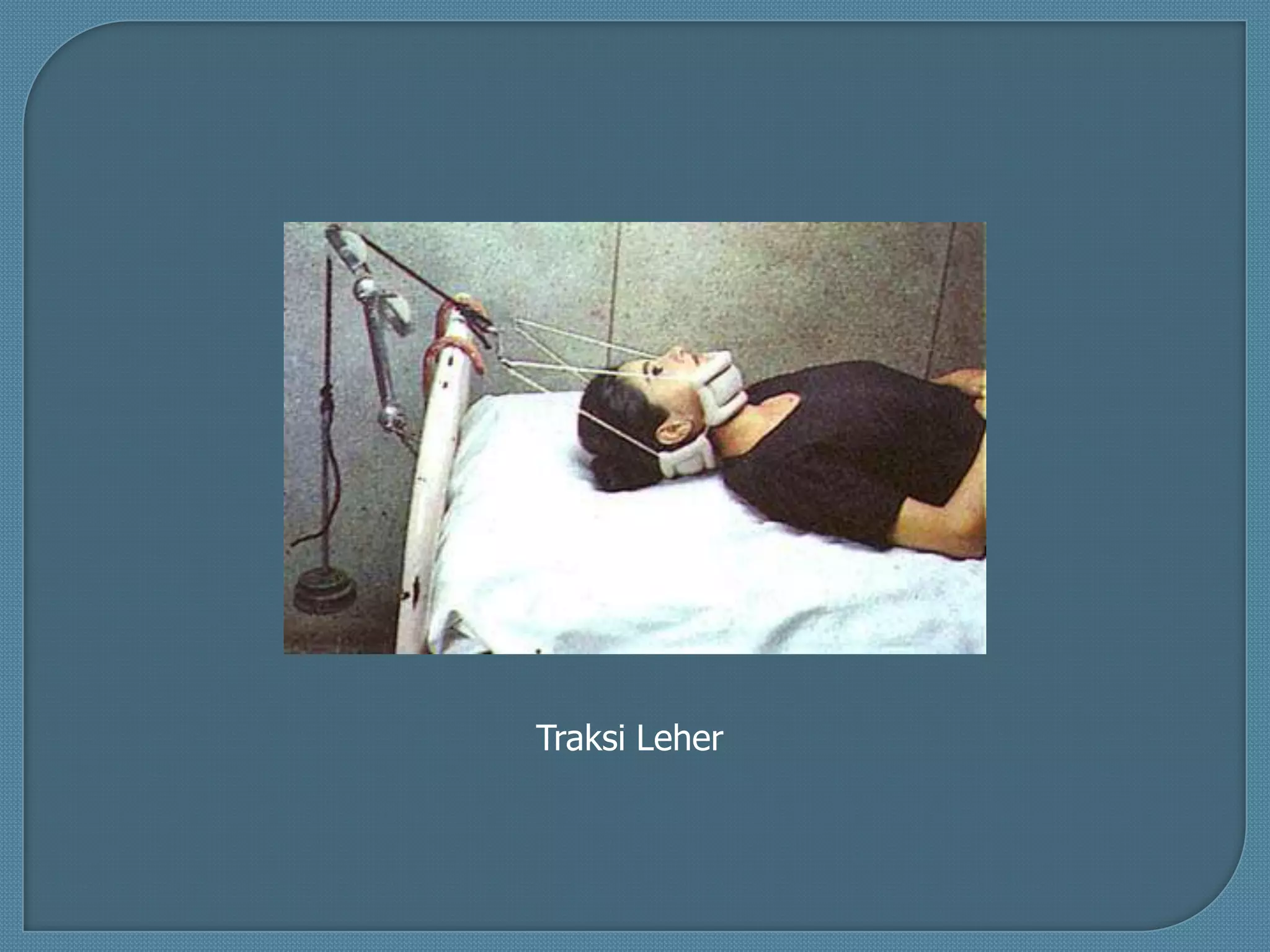 Traksi Dalam Orthopaedi Dr Yuda Umm | PPTX