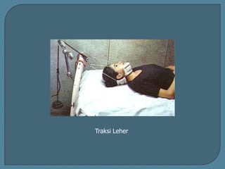 Traksi Dalam Orthopaedi Dr Yuda Umm | PPTX
