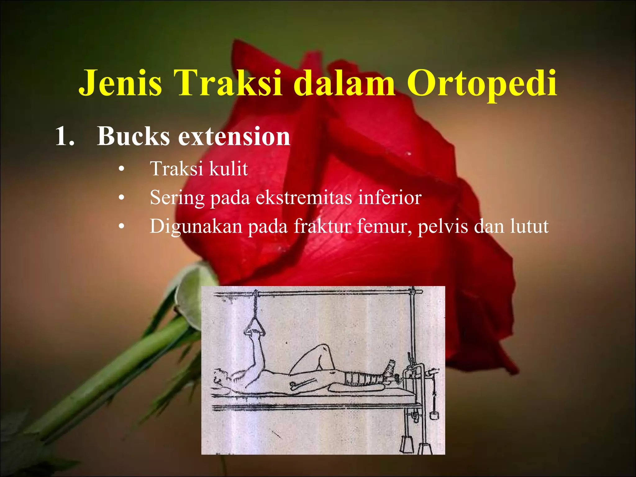 Traksi dalam ortopedik | PPT
