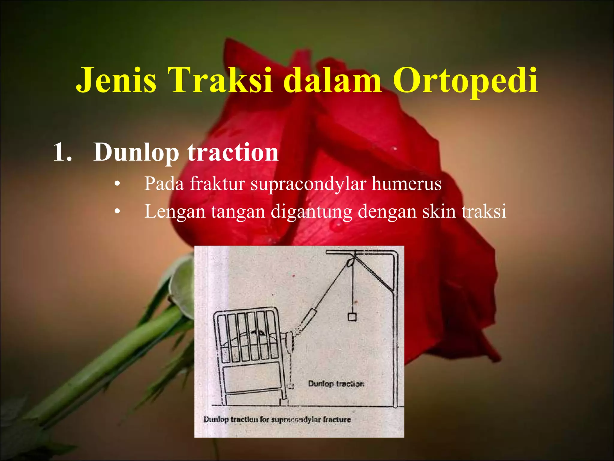 Traksi dalam ortopedik | PPT
