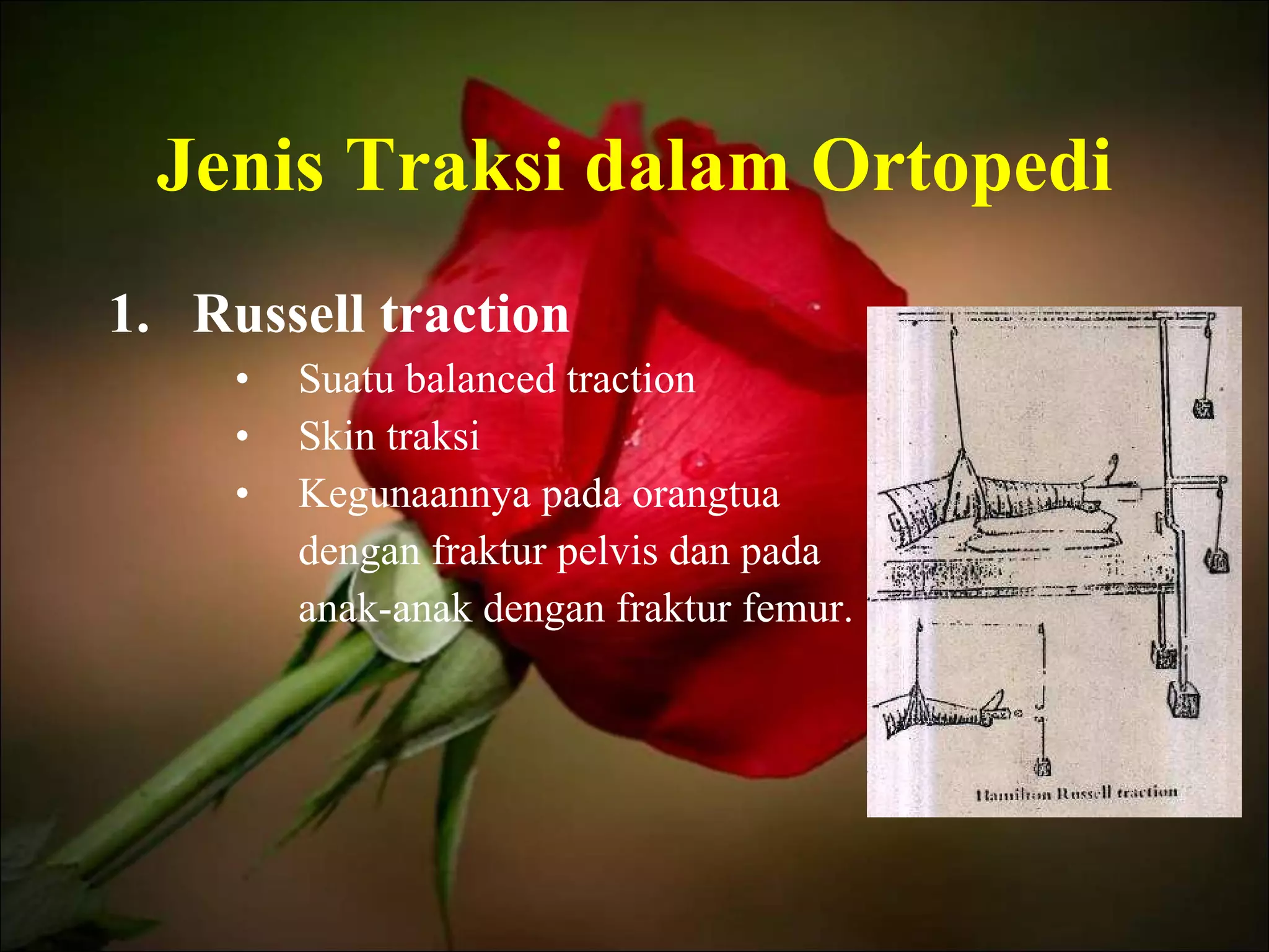 Traksi dalam ortopedik | PPT