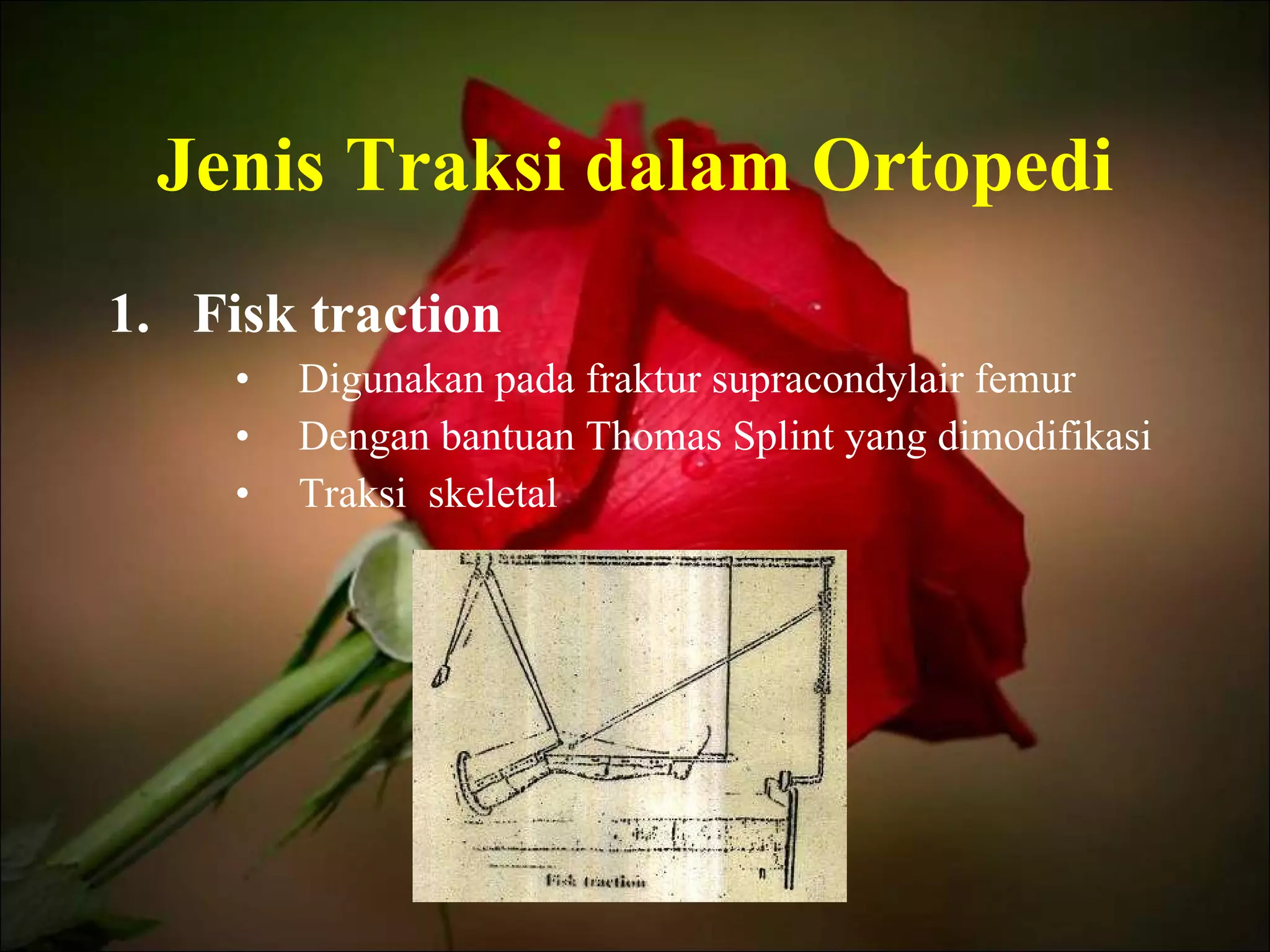 Traksi dalam ortopedik | PPT