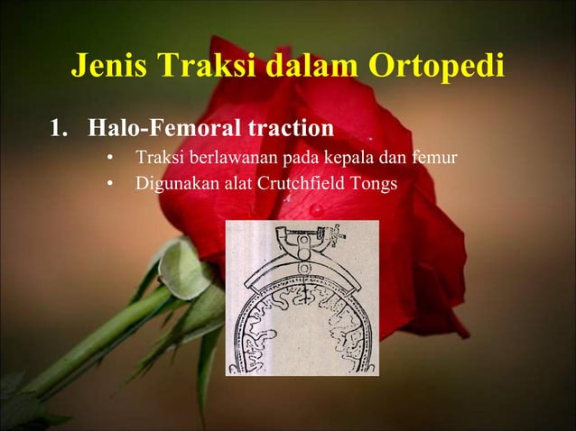 Traksi dalam ortopedik | PPT