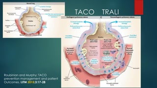 Trali vs taco revised final may 26 2017 dr merayo | PPT
