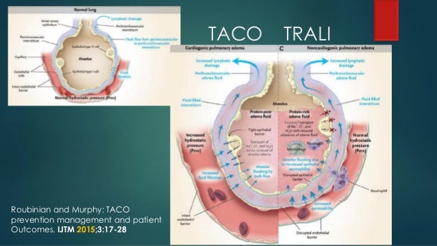 Trali vs taco revised final may 26 2017 dr merayo
