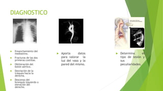 Traumatismo de tórax | PPT