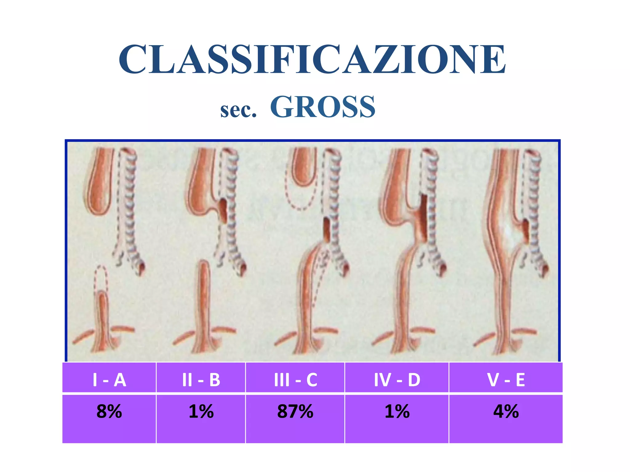 Atresia Esofagea - Chirurgia nel long-gap | PDF