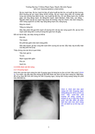 Tran Dich Mang Tim Ok | PDF