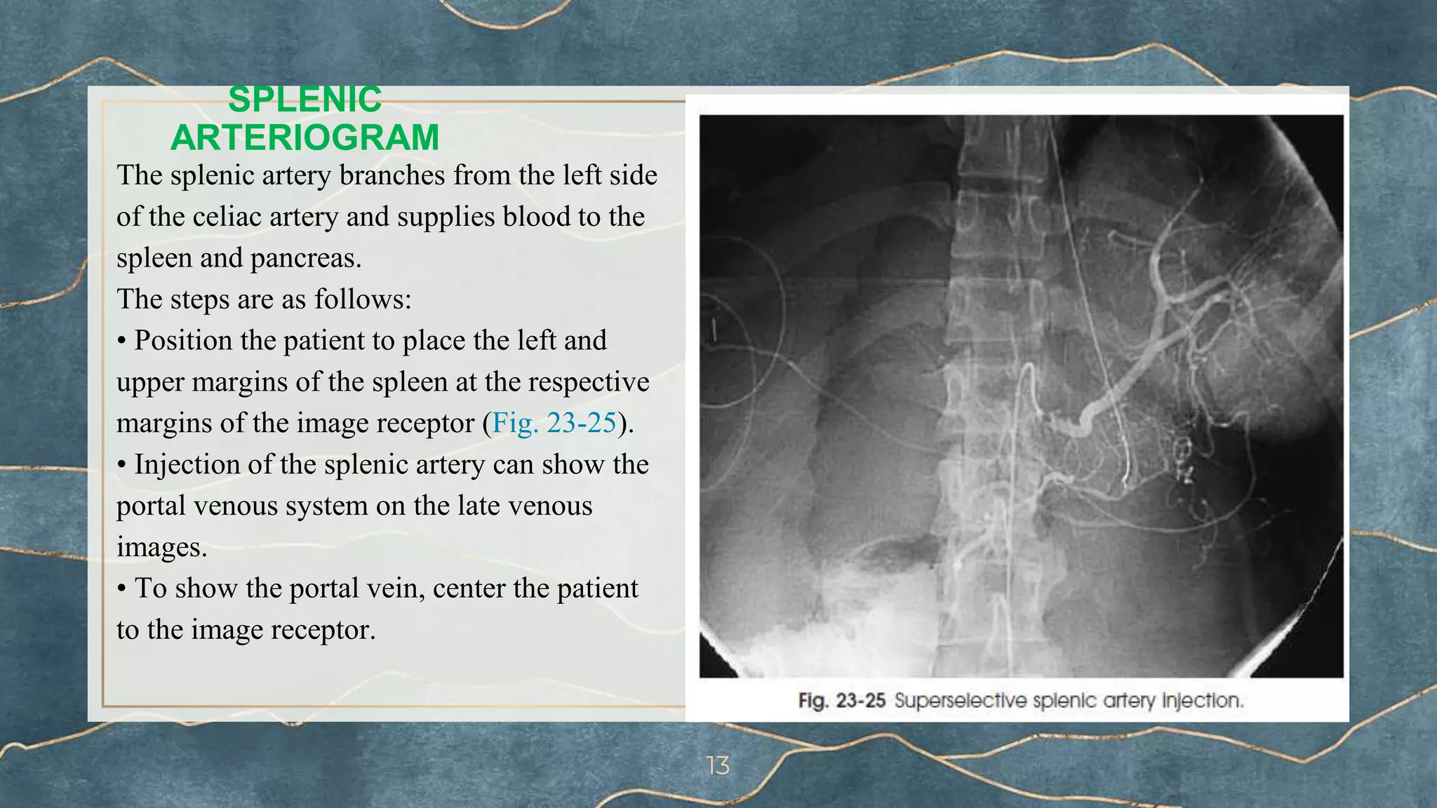 TR angio abdomen, hepatica & renalis.pptx
