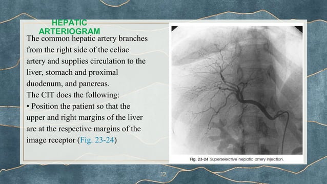 TR angio abdomen, hepatica & renalis.pptx