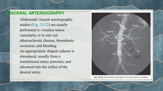 TR angio abdomen, hepatica & renalis.pptx