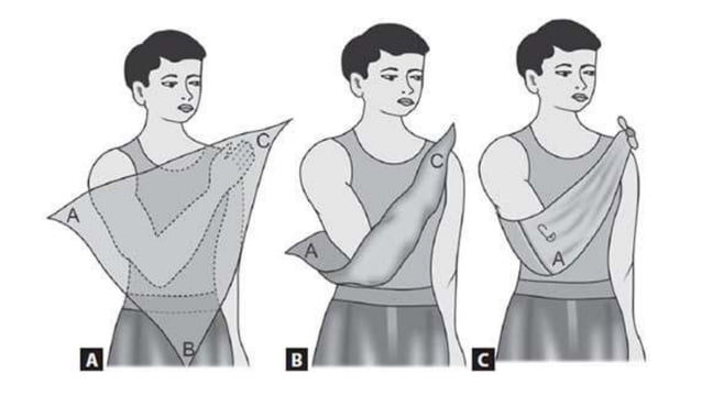 Trangular Bandagers.pptx