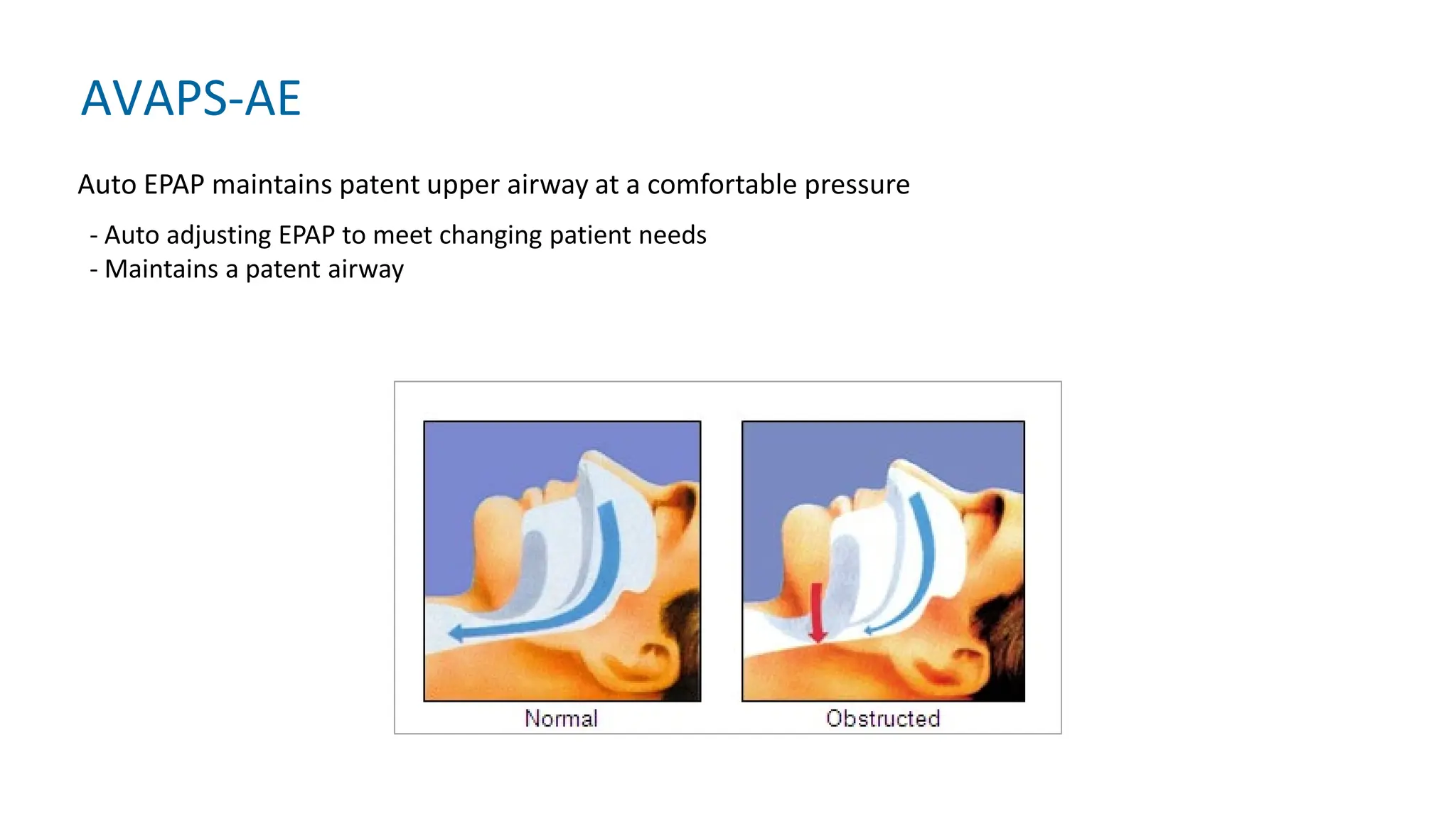 Traning Slides home ventilation workshop trilogy evo.pdf
