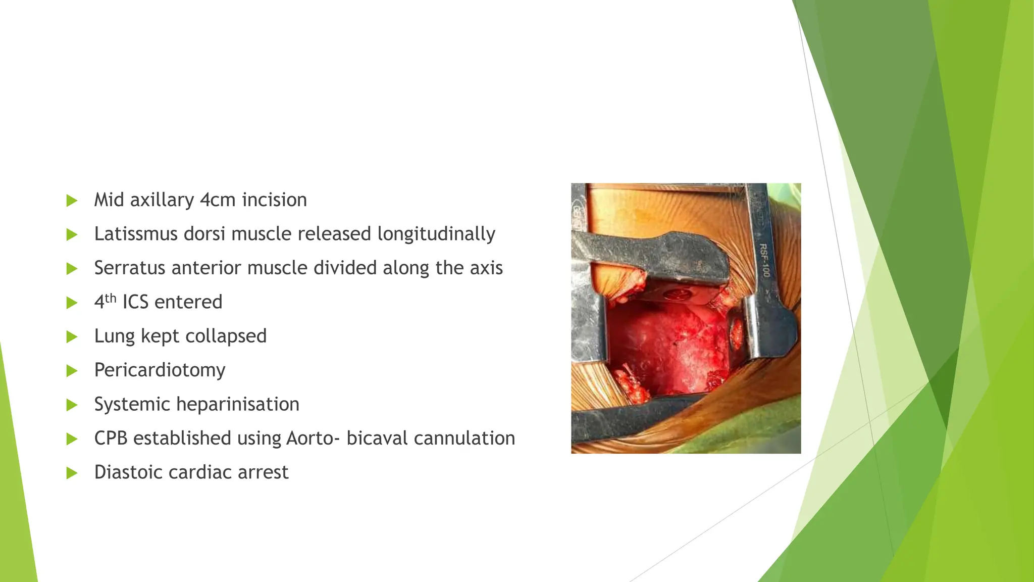 TRANS-AXILLARY APPROACH OF ASD CLOSURE.pptx