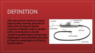 TRANS-ESOPHAGEAL ECHOCARDIOGRAPHY.pptx … | PPTX
