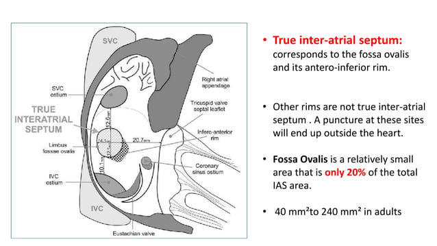 TRANS-SEPTAL PUNCTURE in Interventional Cardiology | PPTX | Heart and ...