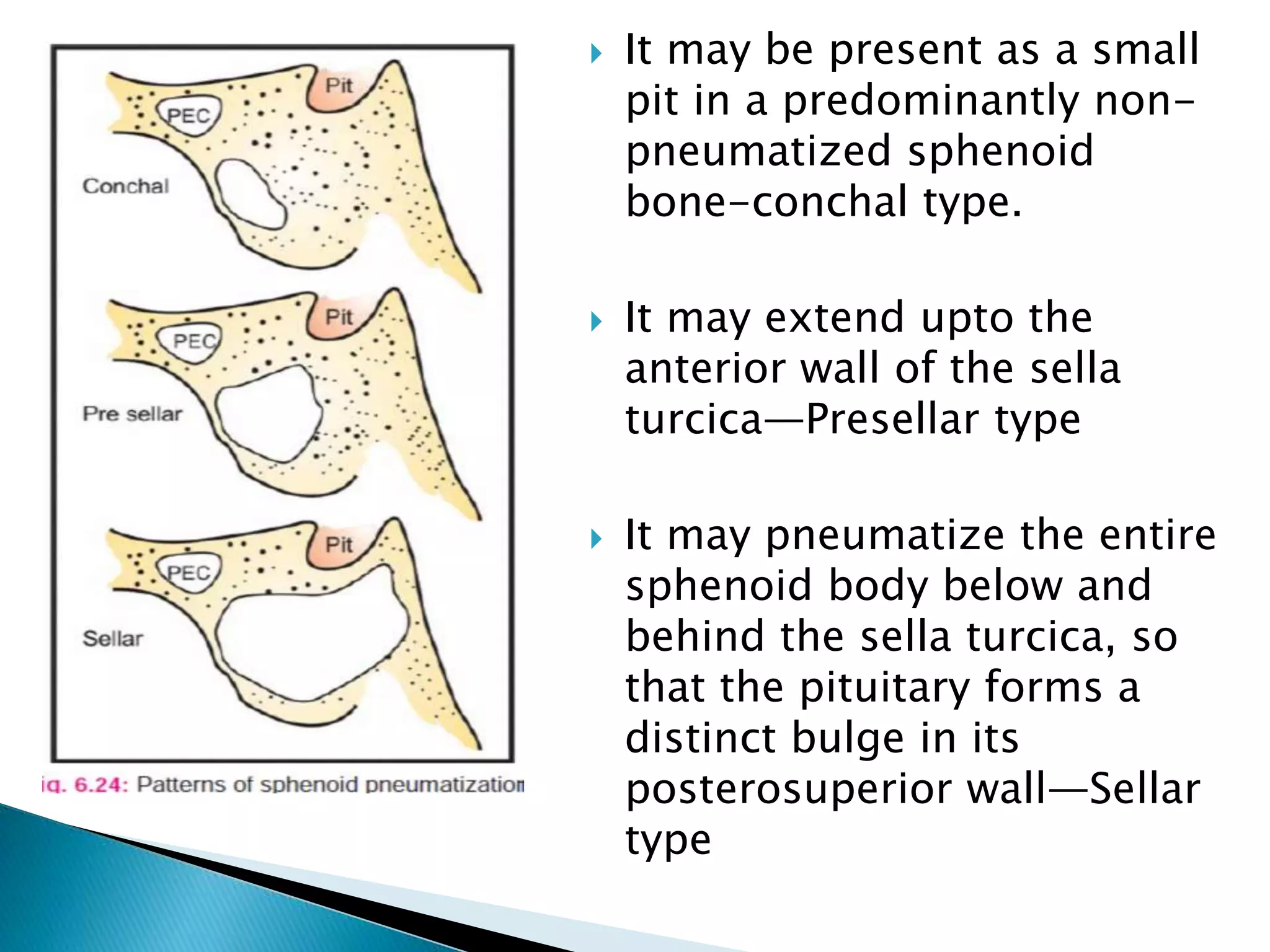 Trans sphenoid hypophysectomy | PPTX