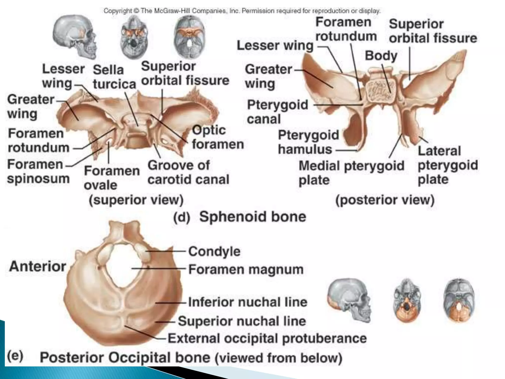 Trans sphenoid hypophysectomy | PPTX