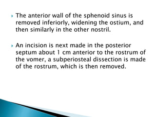 Trans sphenoid hypophysectomy | PPTX