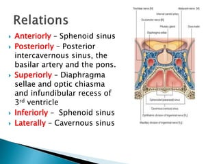 Trans sphenoid hypophysectomy | PPTX