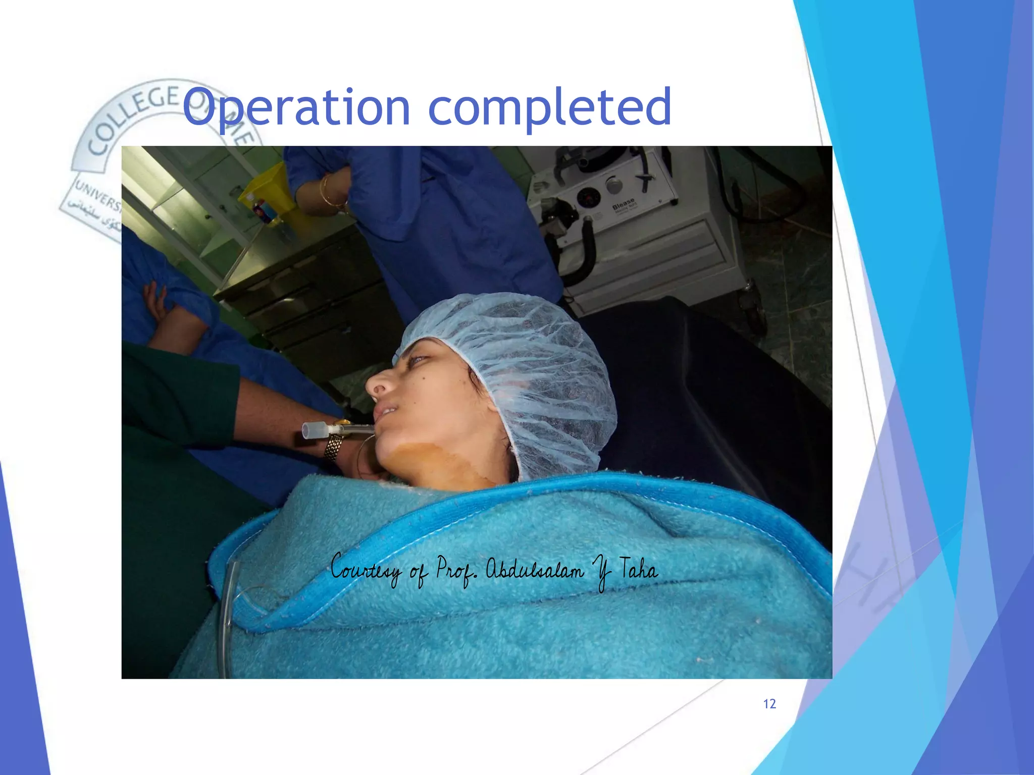 Trans-Sternal Radical Thymectomy for Myaesthenia Gravis.pdf | Thyroid ...