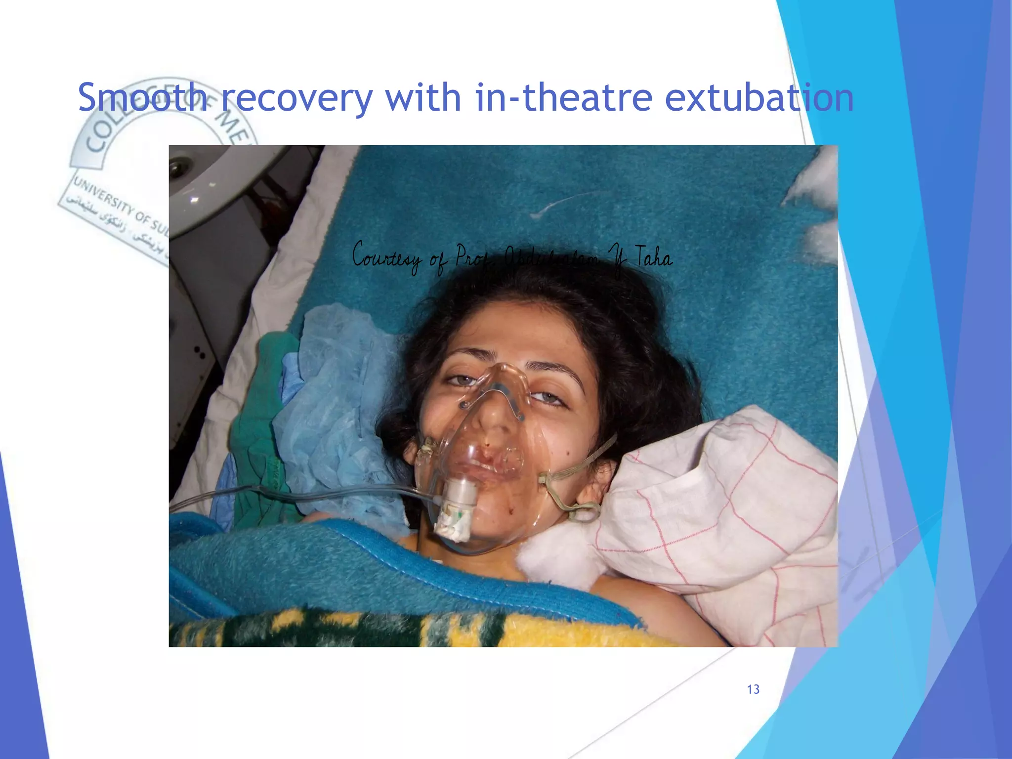 Trans-Sternal Radical Thymectomy for Myaesthenia Gravis.pdf
