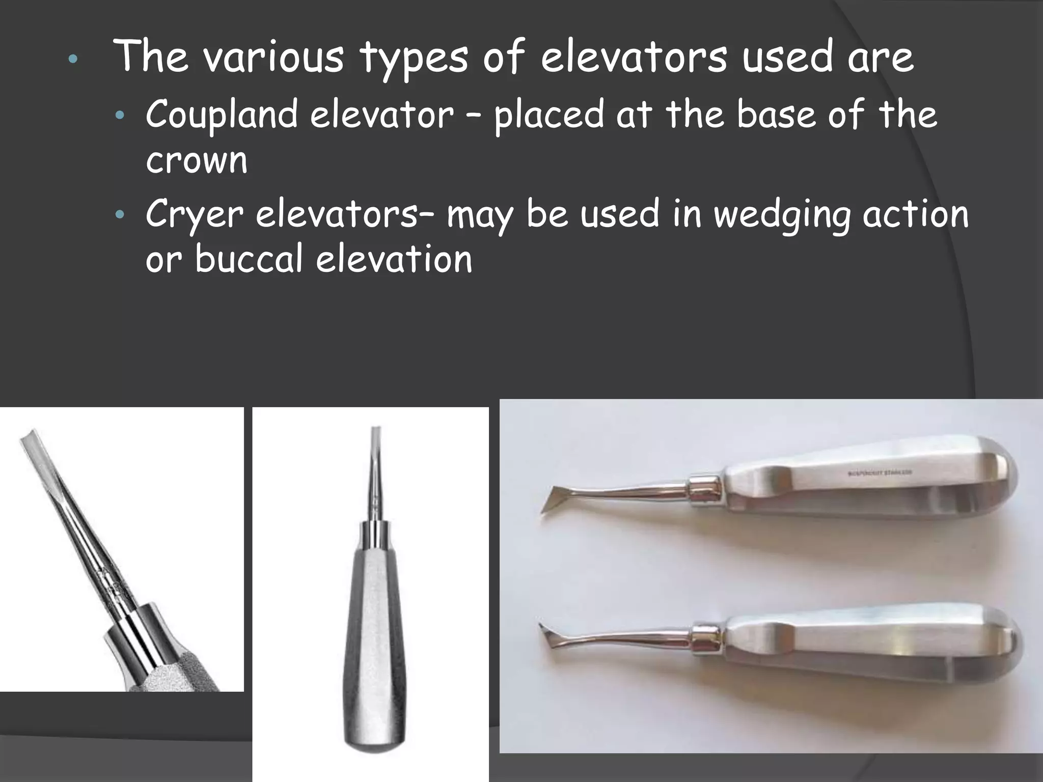 Transalveolar extraction | PPTX