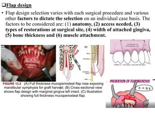 Transalveolar extraction and intraalveolar .pptx