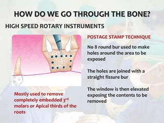 Transalveolar@spark.pptx
