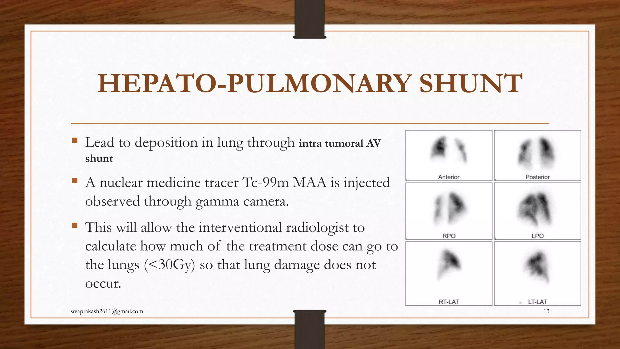 Transarterial radioembolization (tare) | PPTX