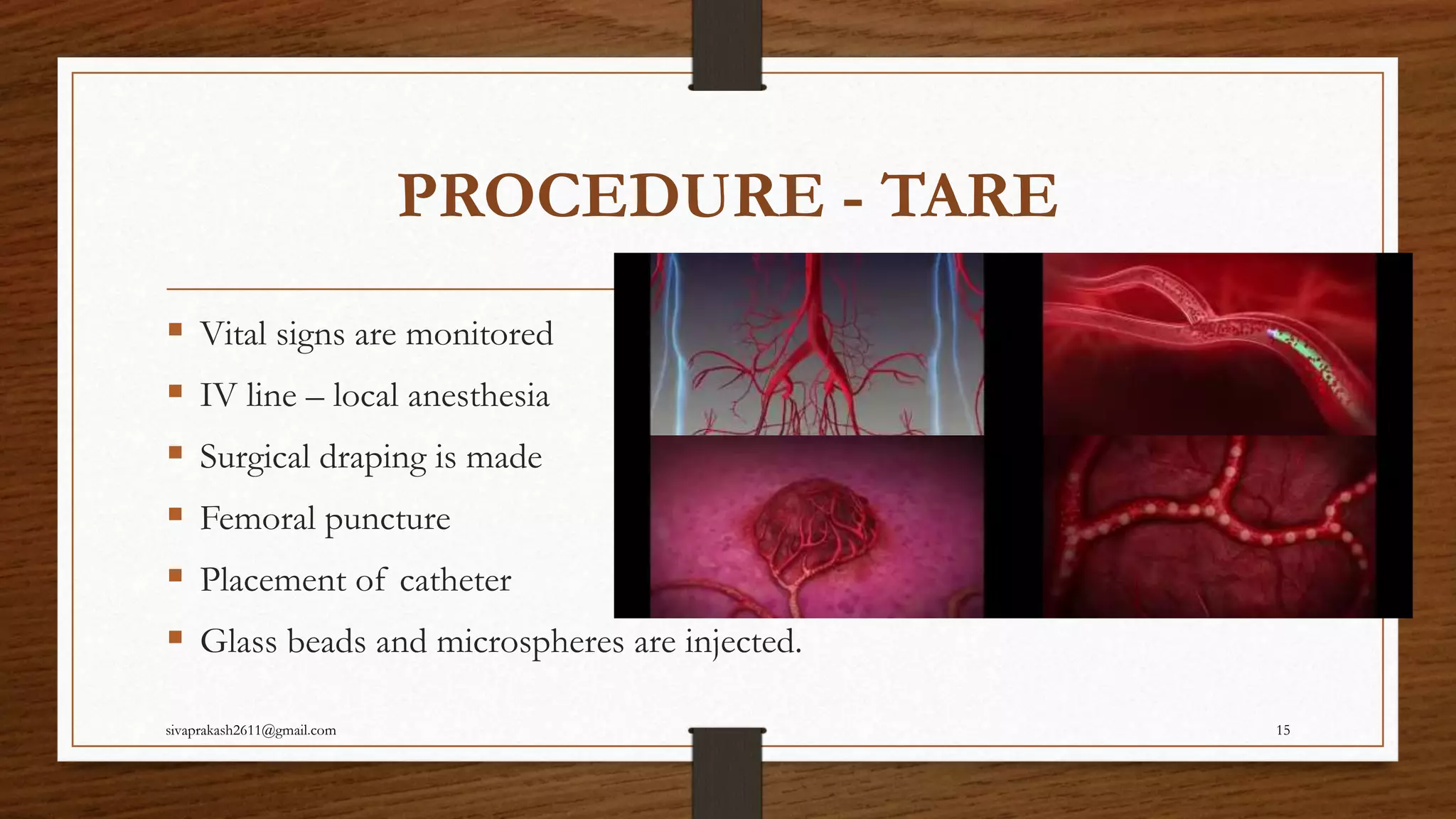 Transarterial radioembolization (tare) | PPTX