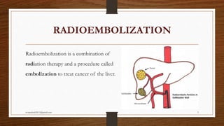 Transarterial radioembolization (tare) | PPTX