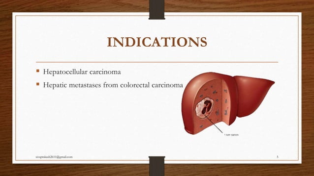 Transarterial radioembolization (tare) | PPTX