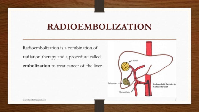 Transarterial radioembolization (tare)