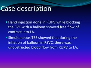 Transcatheter closure of sinus venosus atrial septal defect | PPTX