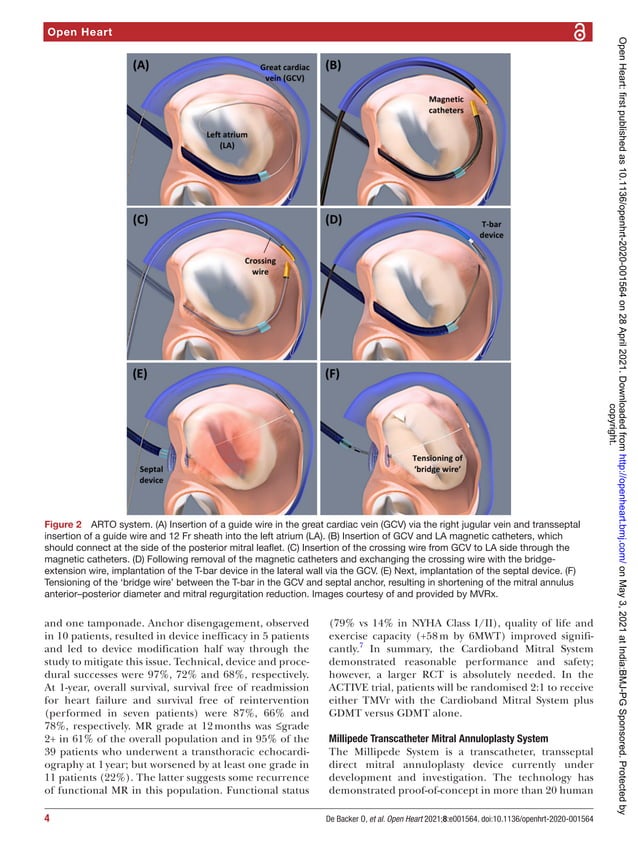 Transcatheter mitral valve repair | PDF | Heart and Cardiovascular ...