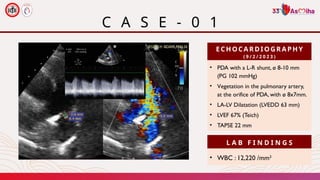 Transcatheter Patent Ductus Arteriosus Closure In Patients With Healed ...