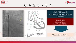 Transcatheter Patent Ductus Arteriosus Closure In Patients With Healed ...