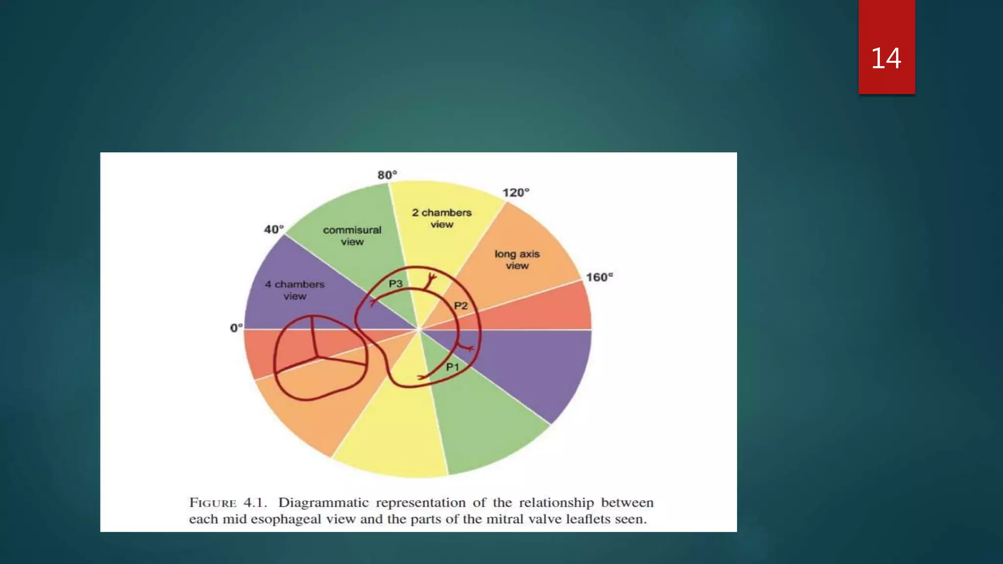 Transcatheter therapy for mitral regurgitation | PPTX