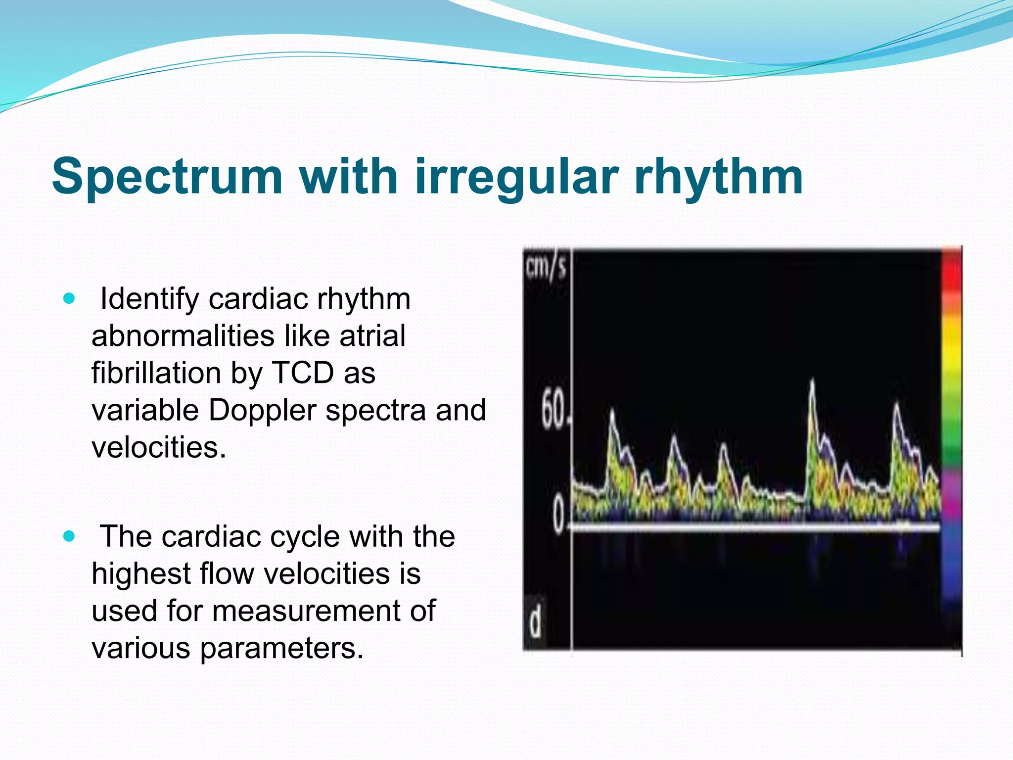 Transcranial doppler | PPTX