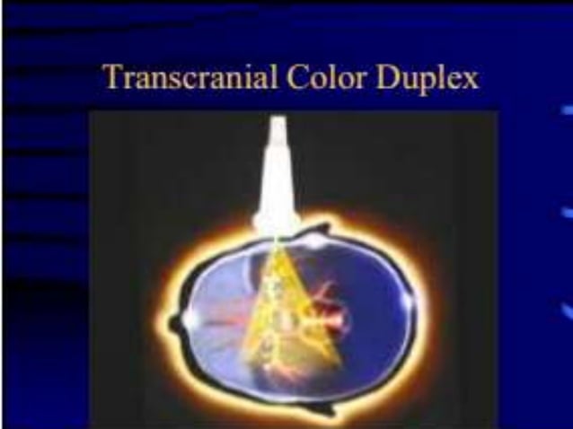 Transcranial doppler | PPTX