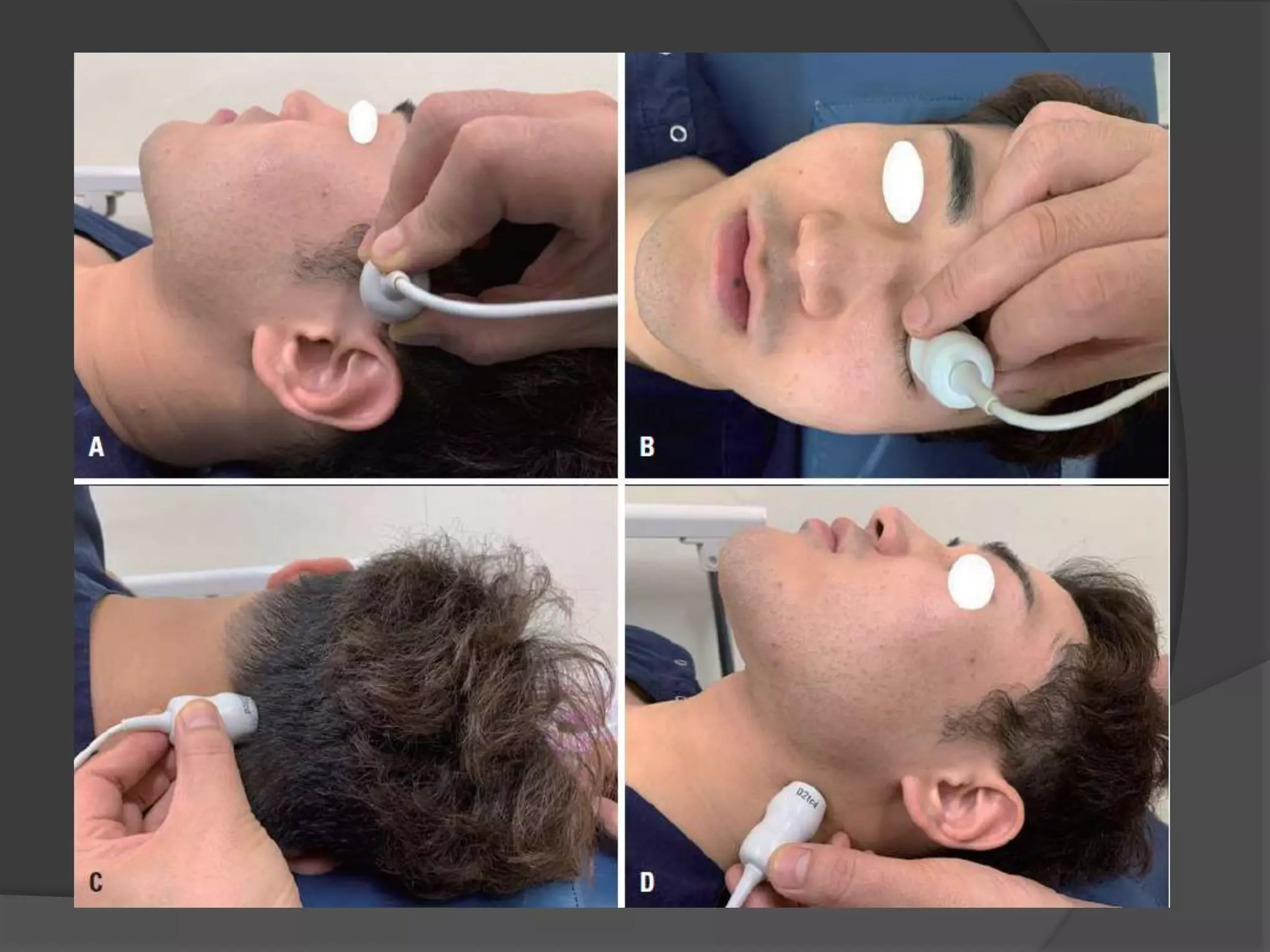 TRANSCRANIAL DOPPLER (1).pptx