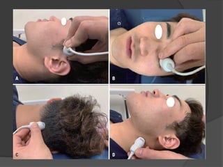 TRANSCRANIAL DOPPLER AND ITS APPLICATION IN NEUROLOGY | PPTX