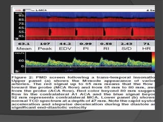TRANSCRANIAL DOPPLER AND ITS APPLICATION IN NEUROLOGY | PPTX