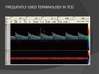 TRANSCRANIAL DOPPLER AND ITS APPLICATION IN NEUROLOGY | PPTX