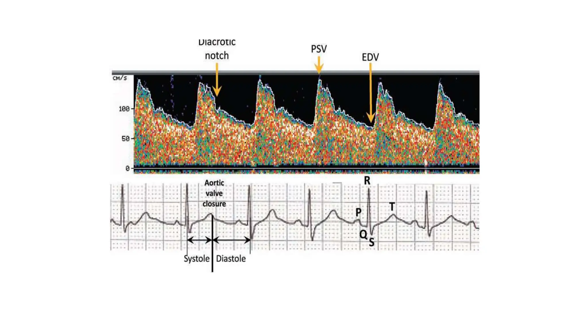Transcranial doppler ultrasound, principles and procuderes | PPTX